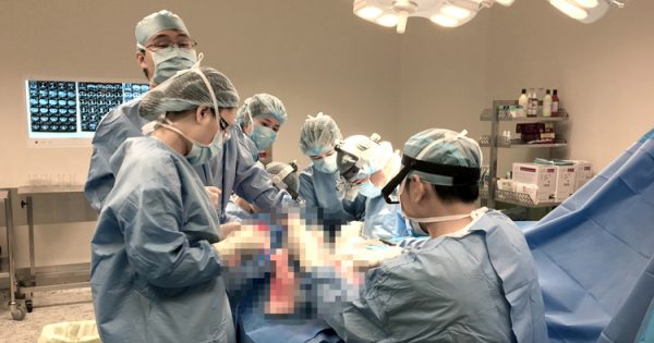 What happens during a 10-hour surgery in the operation theatre? - FV ...