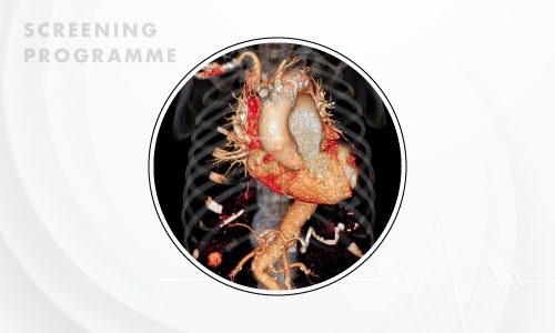 Coronary Artery Disease (CAD) Screening - FV Hospital