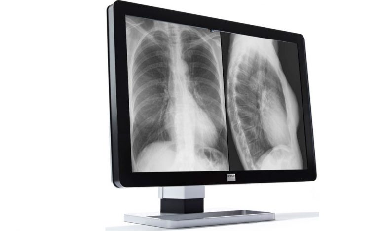 General Radiography (X-ray) - FV Hospital
