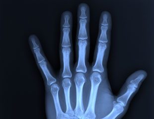 General Radiography (X-ray) - FV Hospital