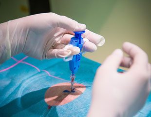 Needle Biopsy of Abdominal Mass under Image-guidance - FV Hospital