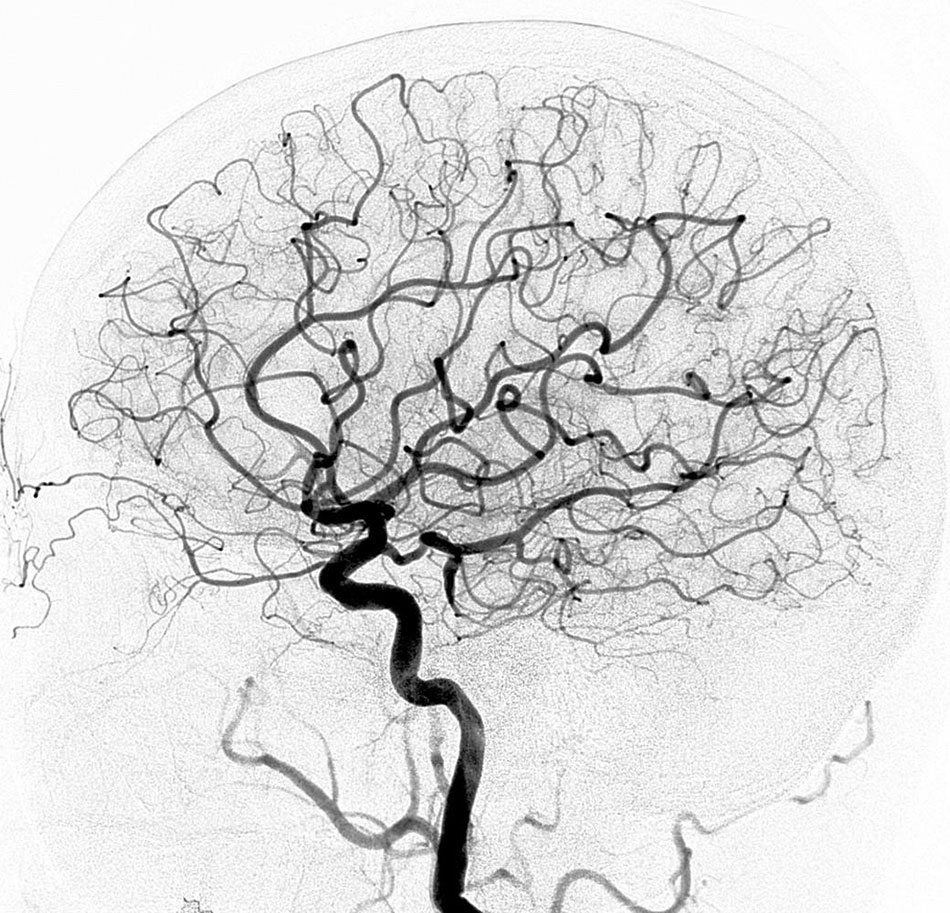 Neurosurgery and Endovascular Neurosurgery - FV Hospital