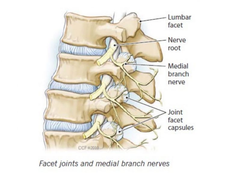 Facet Joint Injections for the Treatment of Pain - FV Hospital