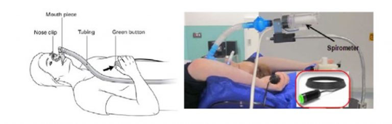 Deep Inspiration Breath Hold and Active Breathing Coordinator - FV Hospital