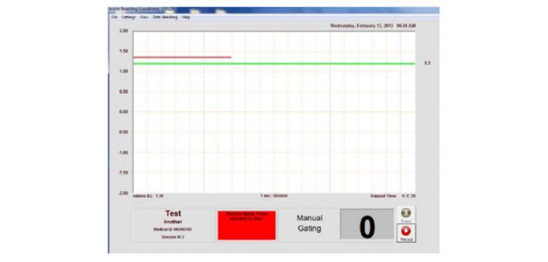 Deep Inspiration Breath Hold and Active Breathing Coordinator - FV Hospital
