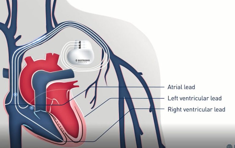 FV Doctors save the life of a patient with serious heart failure using ...
