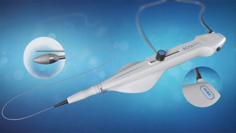 FV Hospital uses diamond drill to treat calcified coronary artery for ...